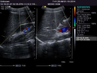Ultrasound Anatomy for 1st- and 2nd- year Medical Students of Tan Tao ...