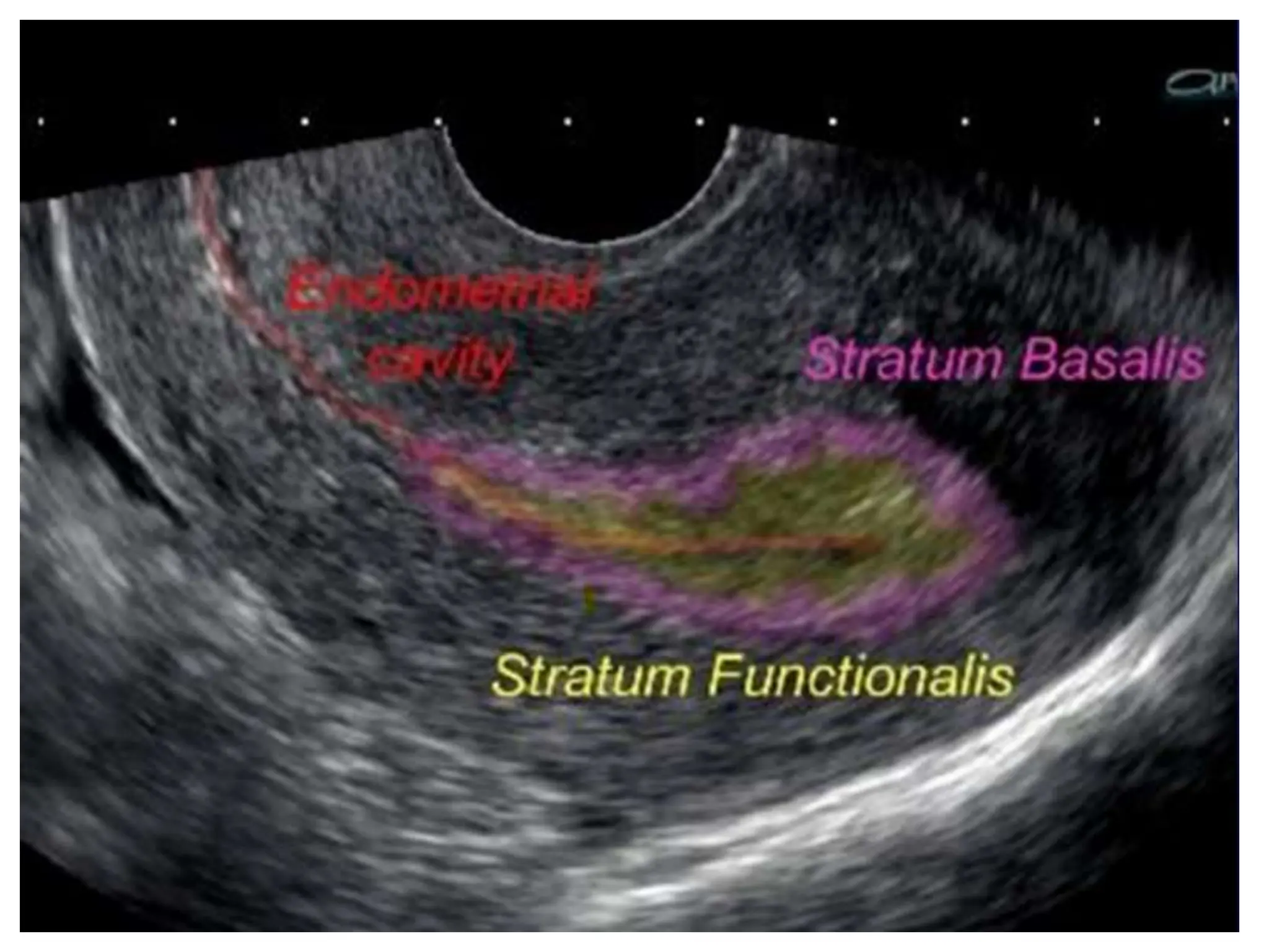 What is uterus Layers of Uterus and 2.pptx