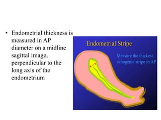 What is uterus Layers of Uterus and 2.pptx