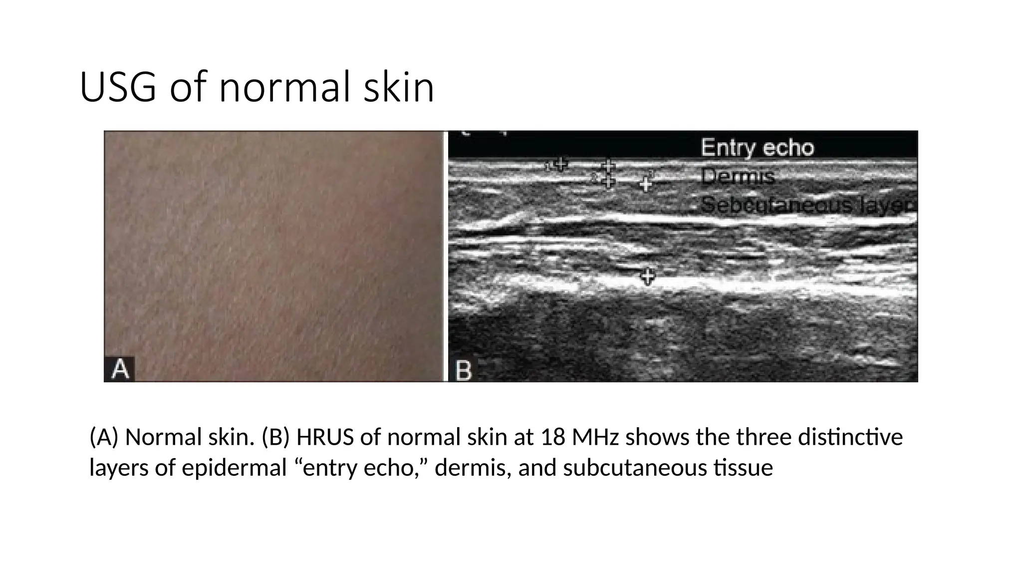 Ultrasound and skin edited- uses of ultrasound technology | PPTX
