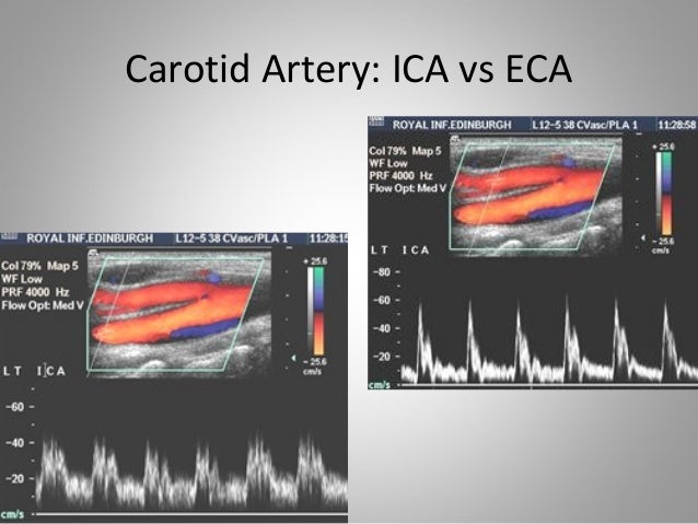 Ultrasound applications stfm 2013