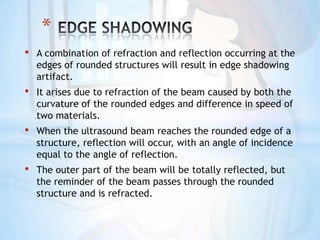 Ultrasound artifacts | PPTX