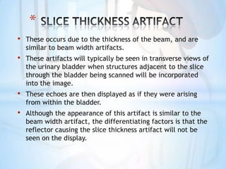 Ultrasound artifacts | PPTX