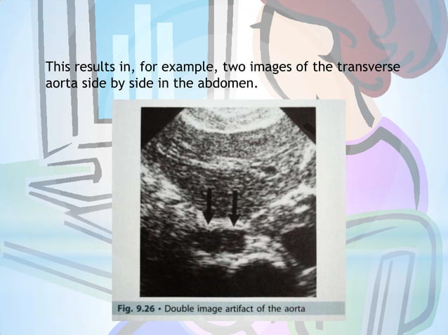 Ultrasound artifacts | PPTX | Digital Audio | Computer Software and Applications