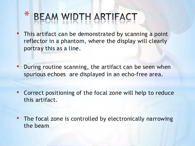 Ultrasound artifacts