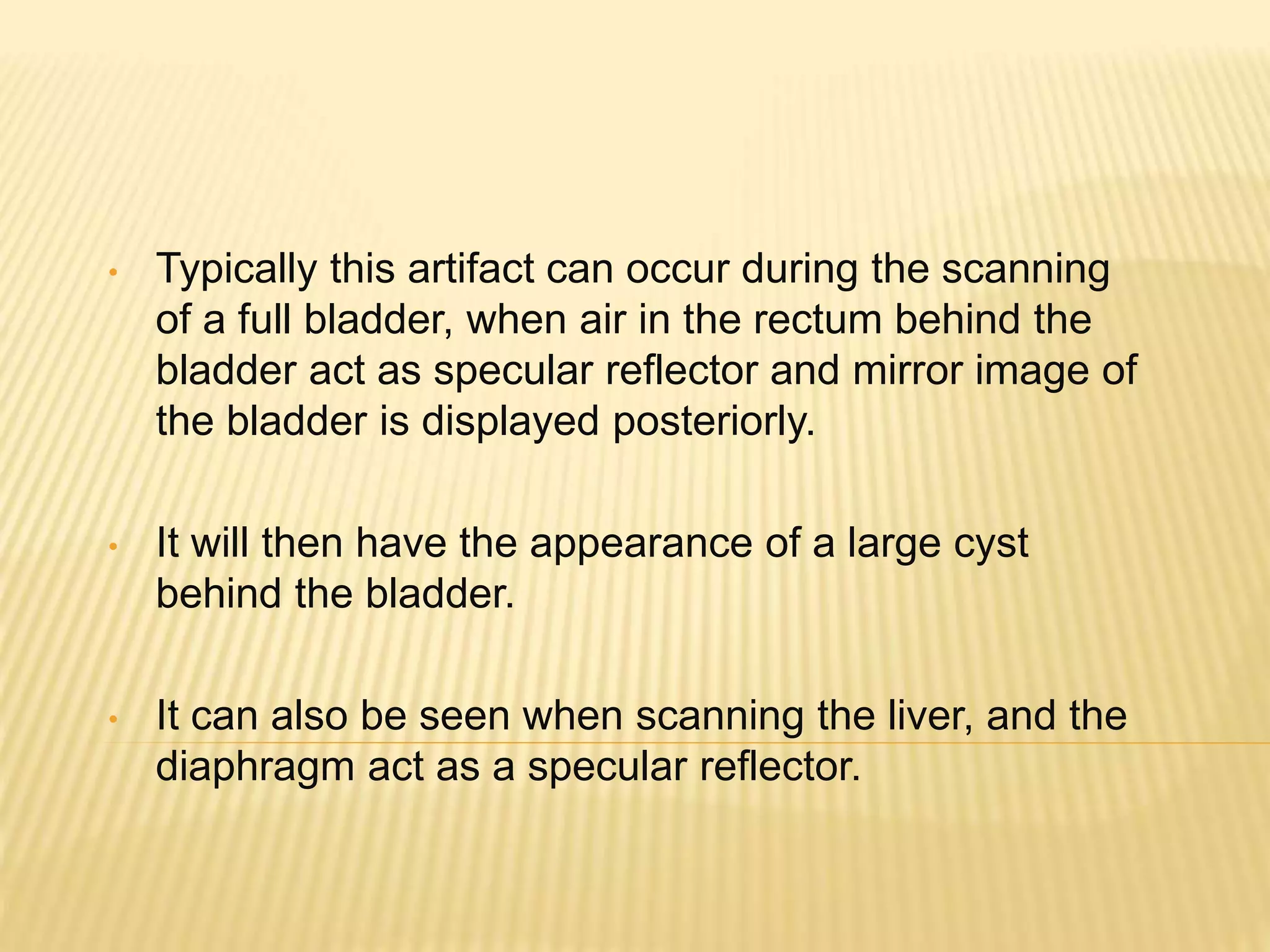 Ultrasound Artifact | PPTX