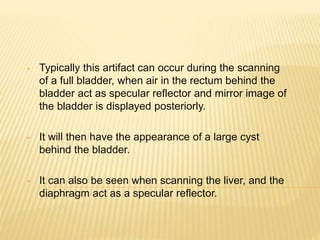 Ultrasound Artifact | PPTX