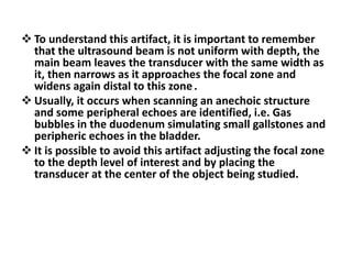 ultrasoundartifacts-200113150706.pdf