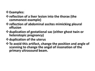 ultrasoundartifacts-200113150706.pdf