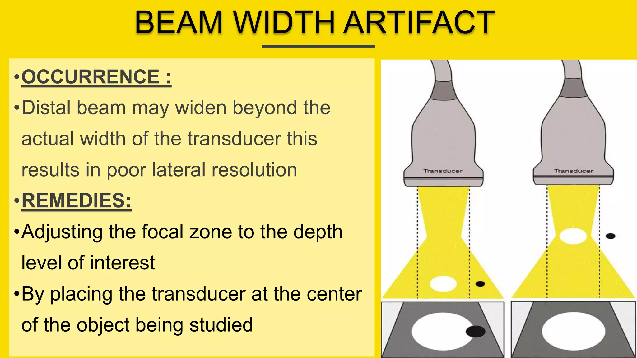 Ultrasound artifacts | PPTX