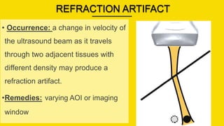 Ultrasound artifacts | PPTX