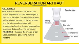 Ultrasound artifacts | PPTX