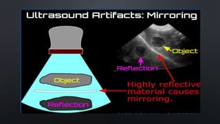 ULTRASOUND ARTIFACTS.pptx