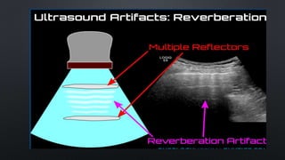 ULTRASOUND ARTIFACTS.pptx