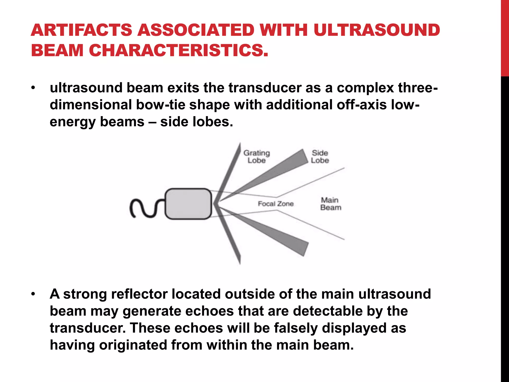 Ultrasound artifacts and contrast enhanced ultrasound | PPTX