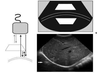 Ultrasound artifacts and contrast enhanced ultrasound | PPTX