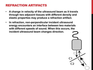 Ultrasound artifacts and contrast enhanced ultrasound | PPTX