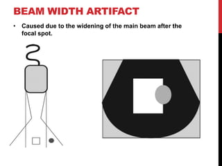 Ultrasound artifacts and contrast enhanced ultrasound | PPTX