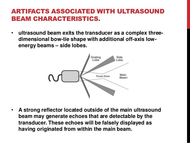 Beam width artifact. : 네이버 블로그