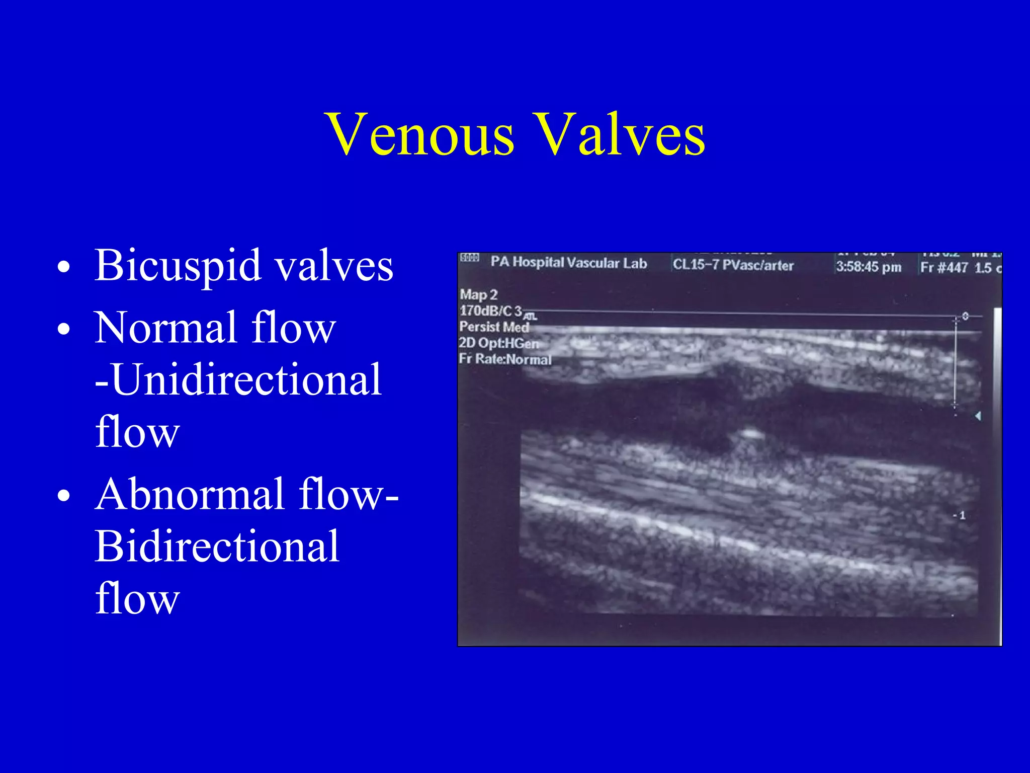 Ultrasound Assessment Of Chronic Venous Disease | PPT