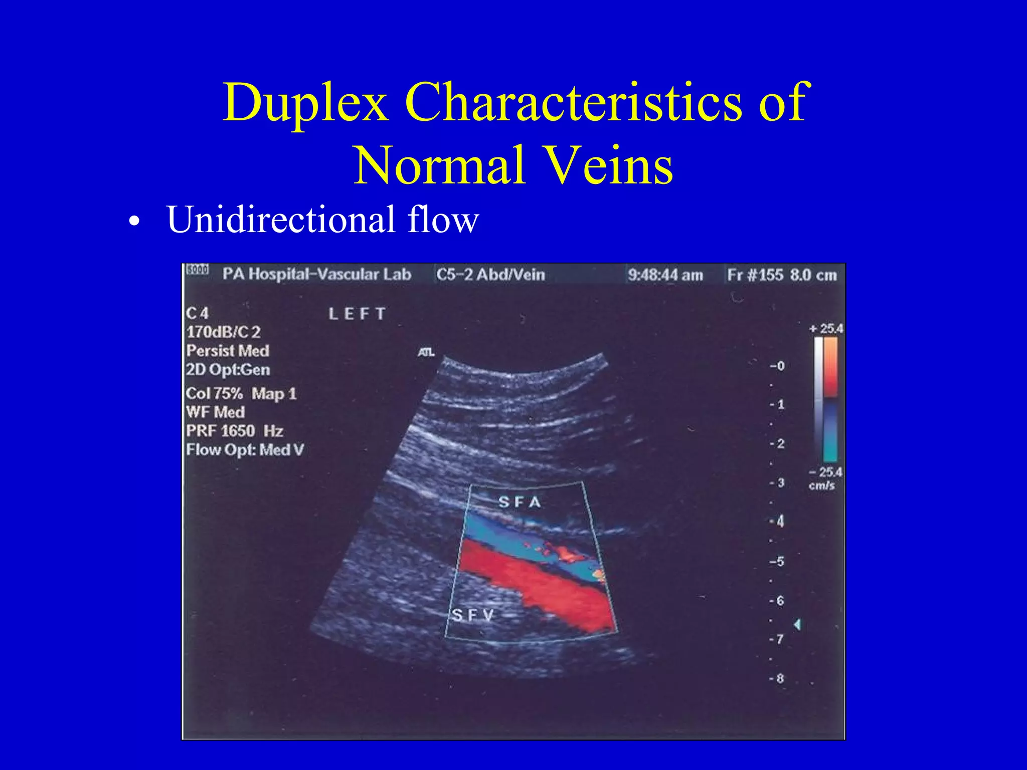 Ultrasound Assessment Of Chronic Venous Disease | PPT