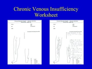 Ultrasound Assessment Of Chronic Venous Disease | PPT