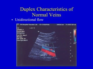 Ultrasound Assessment Of Chronic Venous Disease | PPT