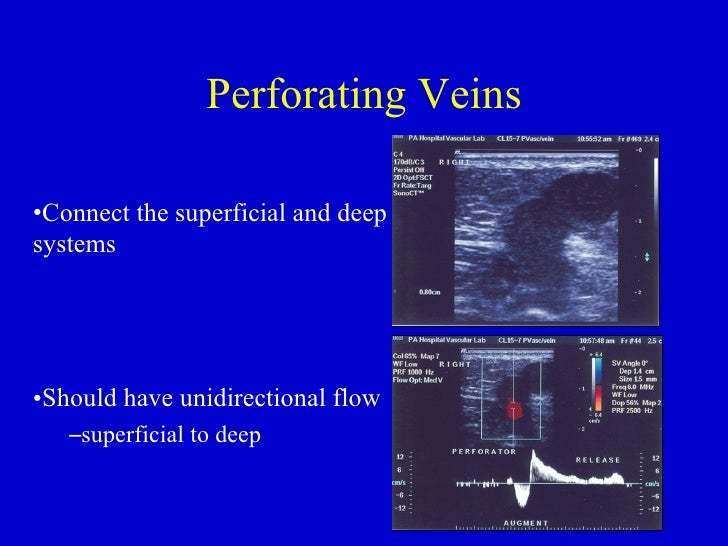 Ultrasound Assessment Of Chronic Venous Disease