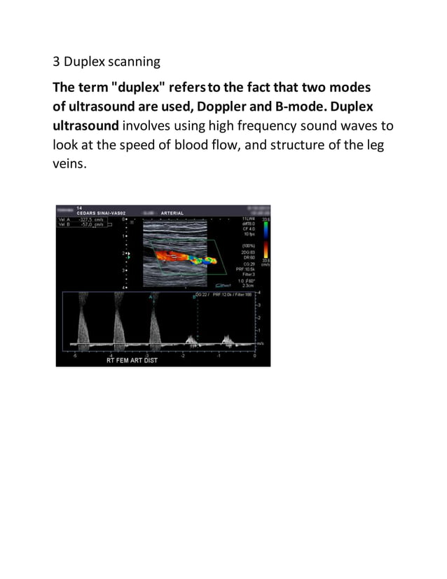 Ultrasound assignment 3 mark question and answer | DOCX
