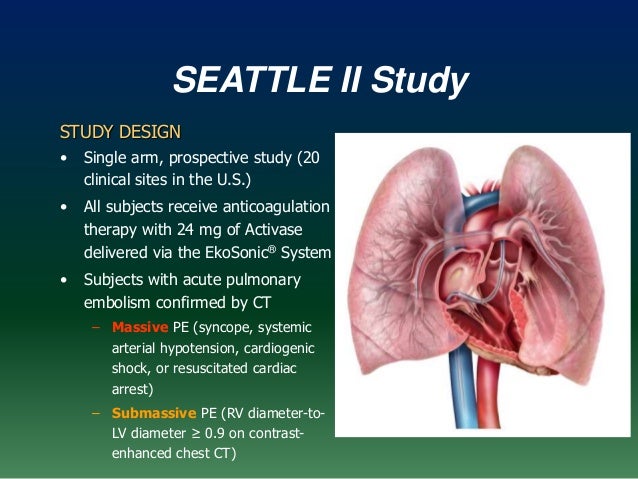 Ultrasound Assisted Thrombolysis For Vte Turkish Experience