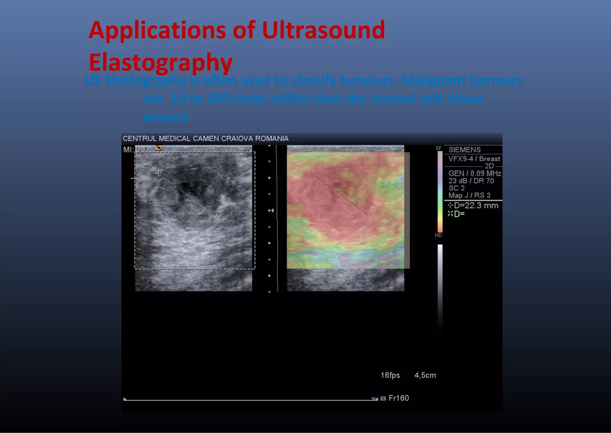 Basics of Ultrasound | PPT