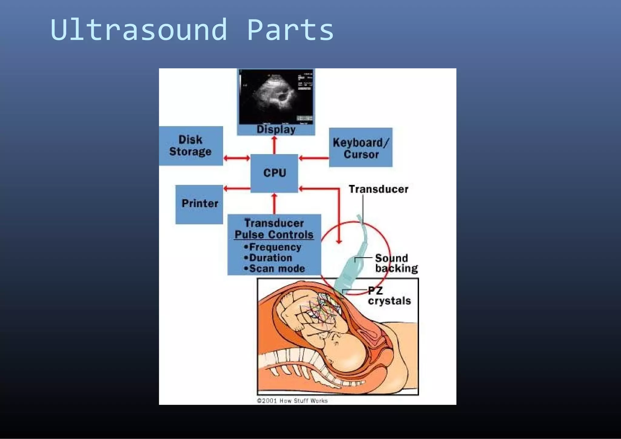 Basics of Ultrasound | PPT