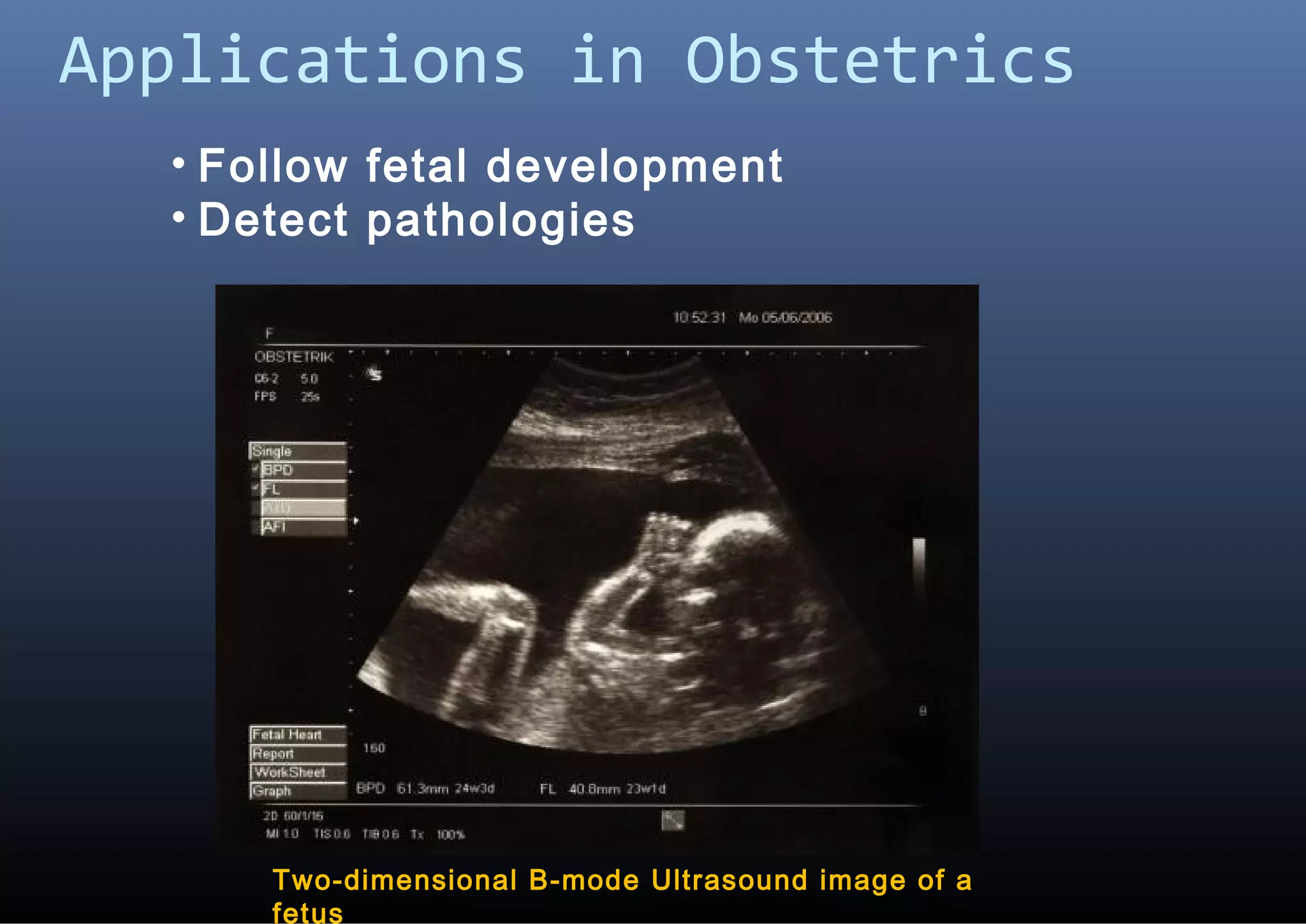 Basics of Ultrasound | PPT