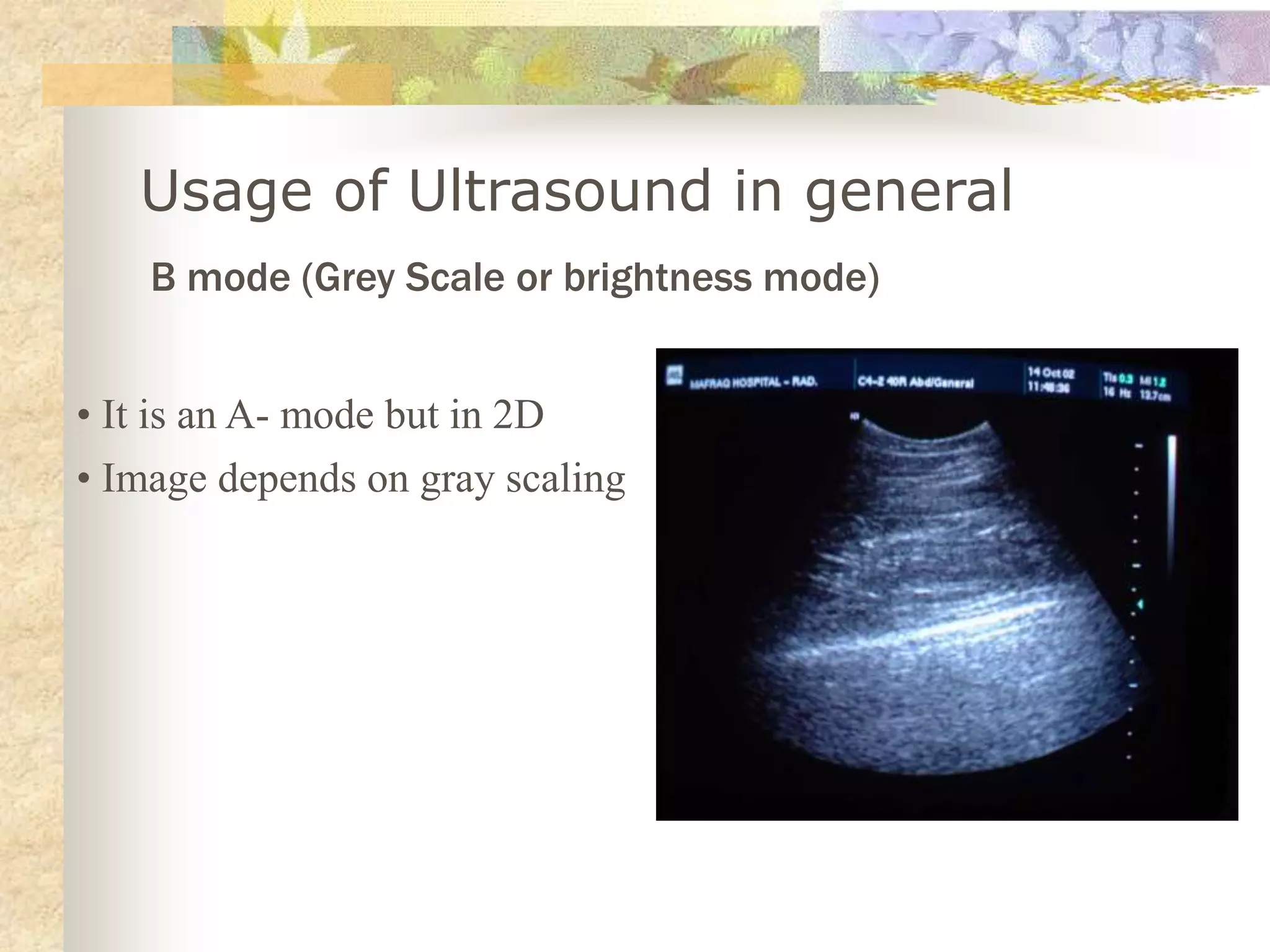 Basics of Diagnostic Ultrasound | PPT
