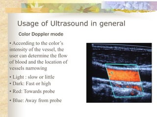 Basics of Diagnostic Ultrasound | PPT