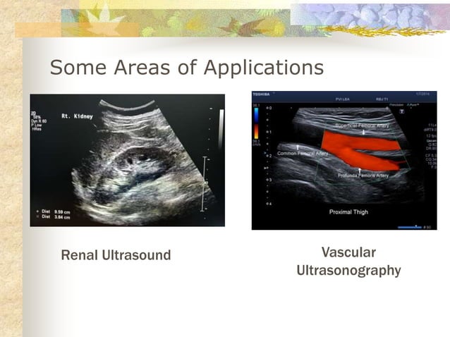 Basics of Diagnostic Ultrasound | PPT | Digital Audio | Computer ...