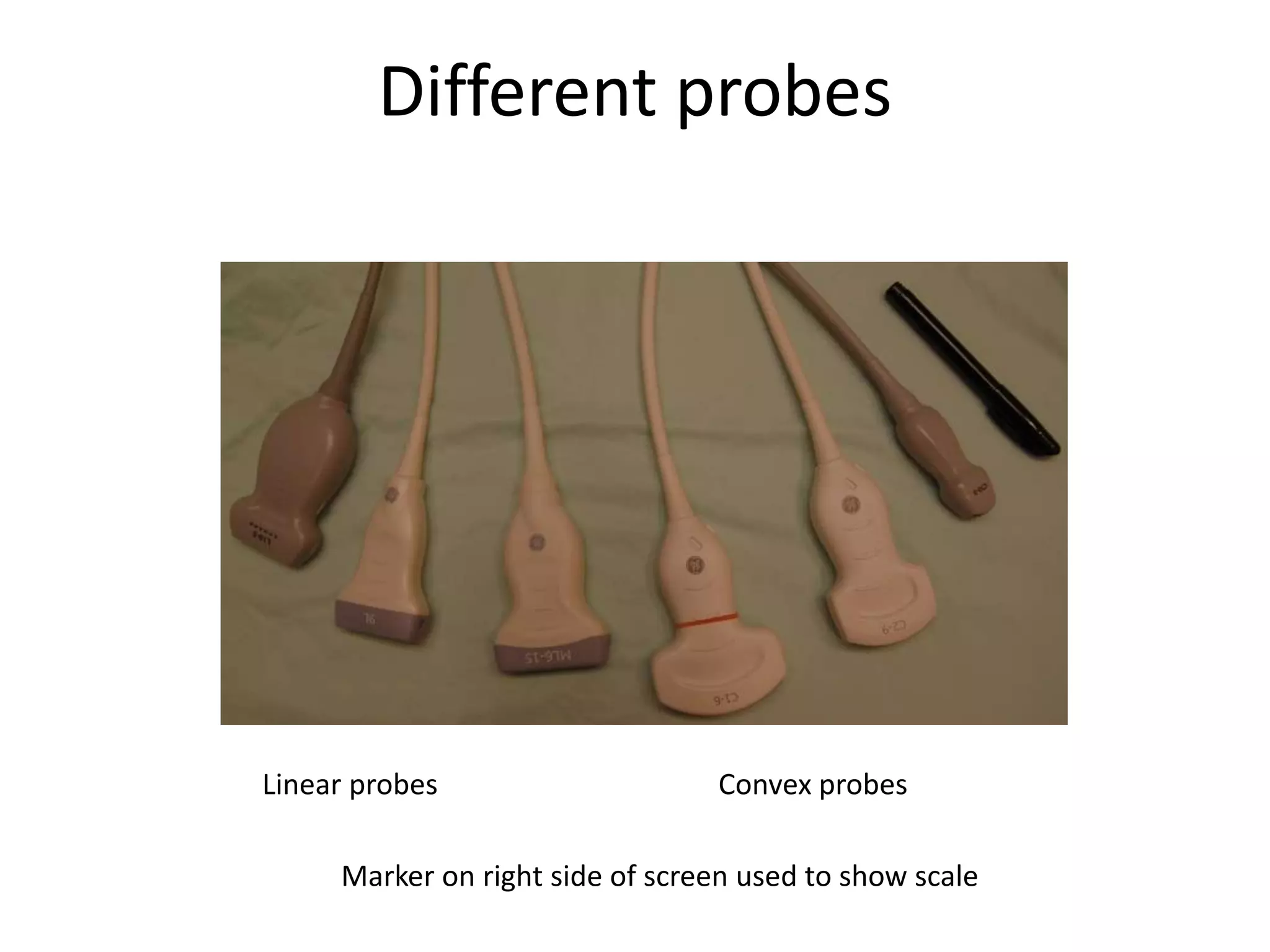 Ultrasound Basics.ppt