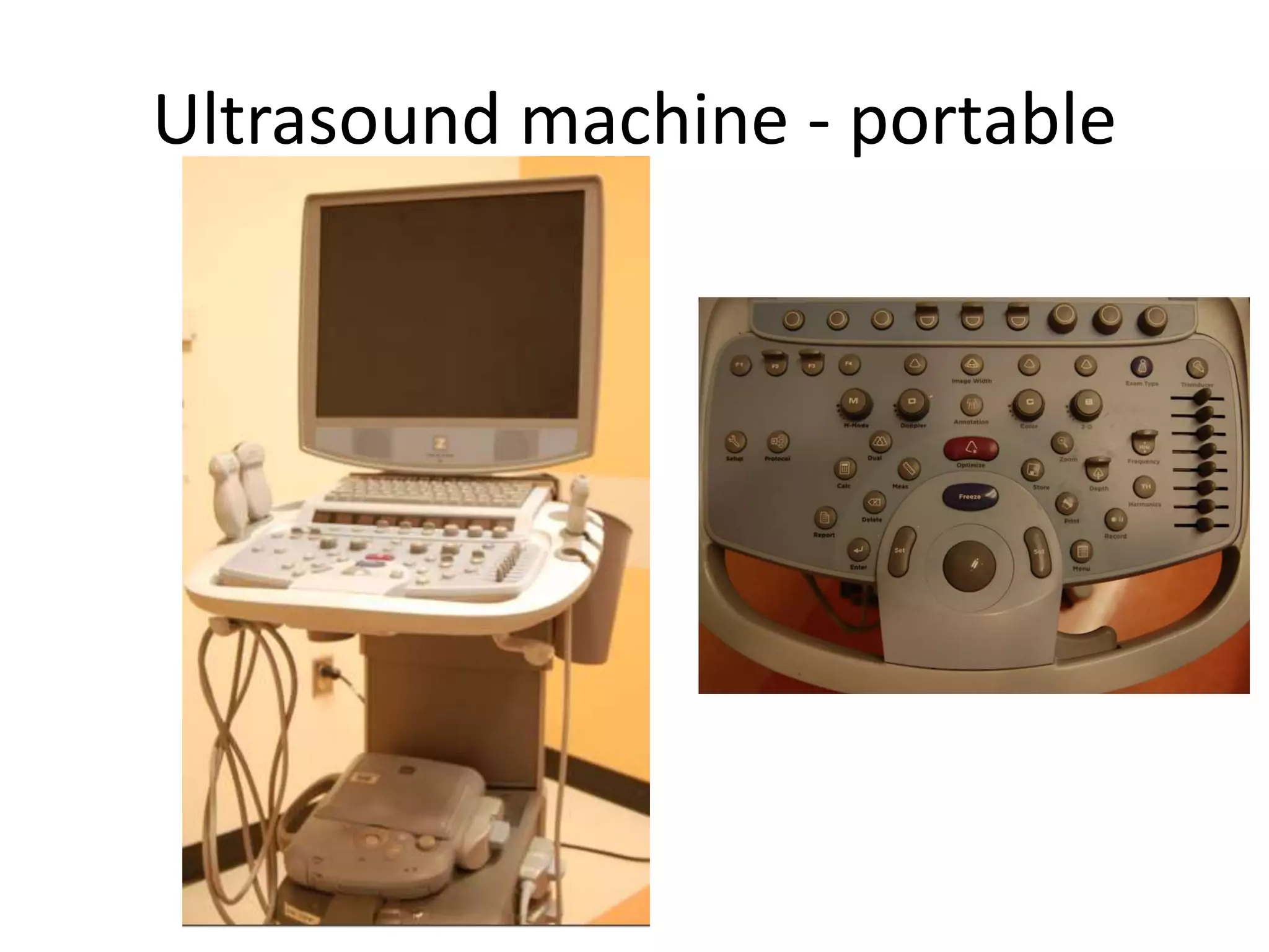 Ultrasound Basics.ppt