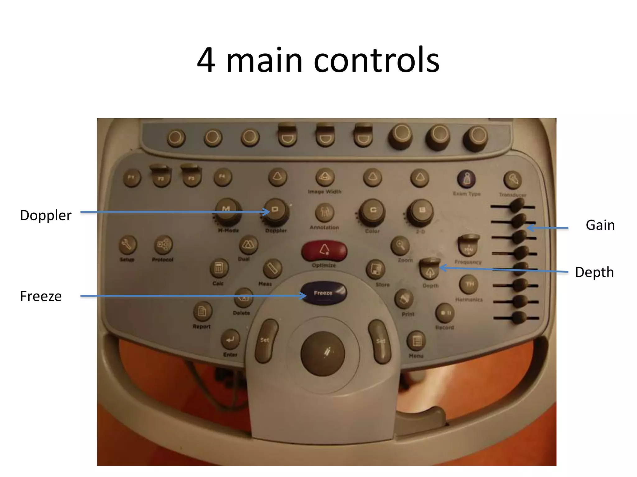 Ultrasound Basics.ppt