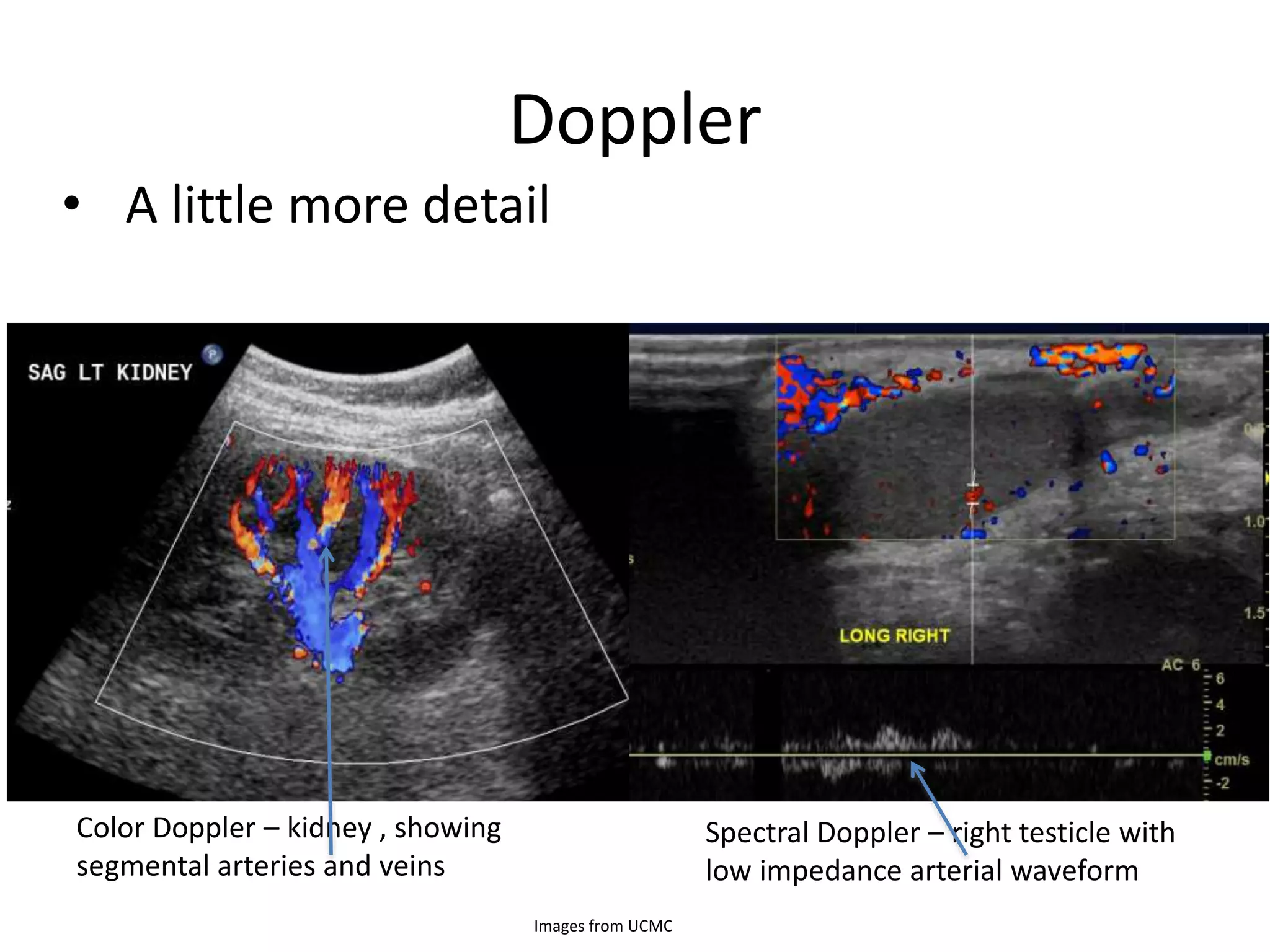 Ultrasound Basics.ppt