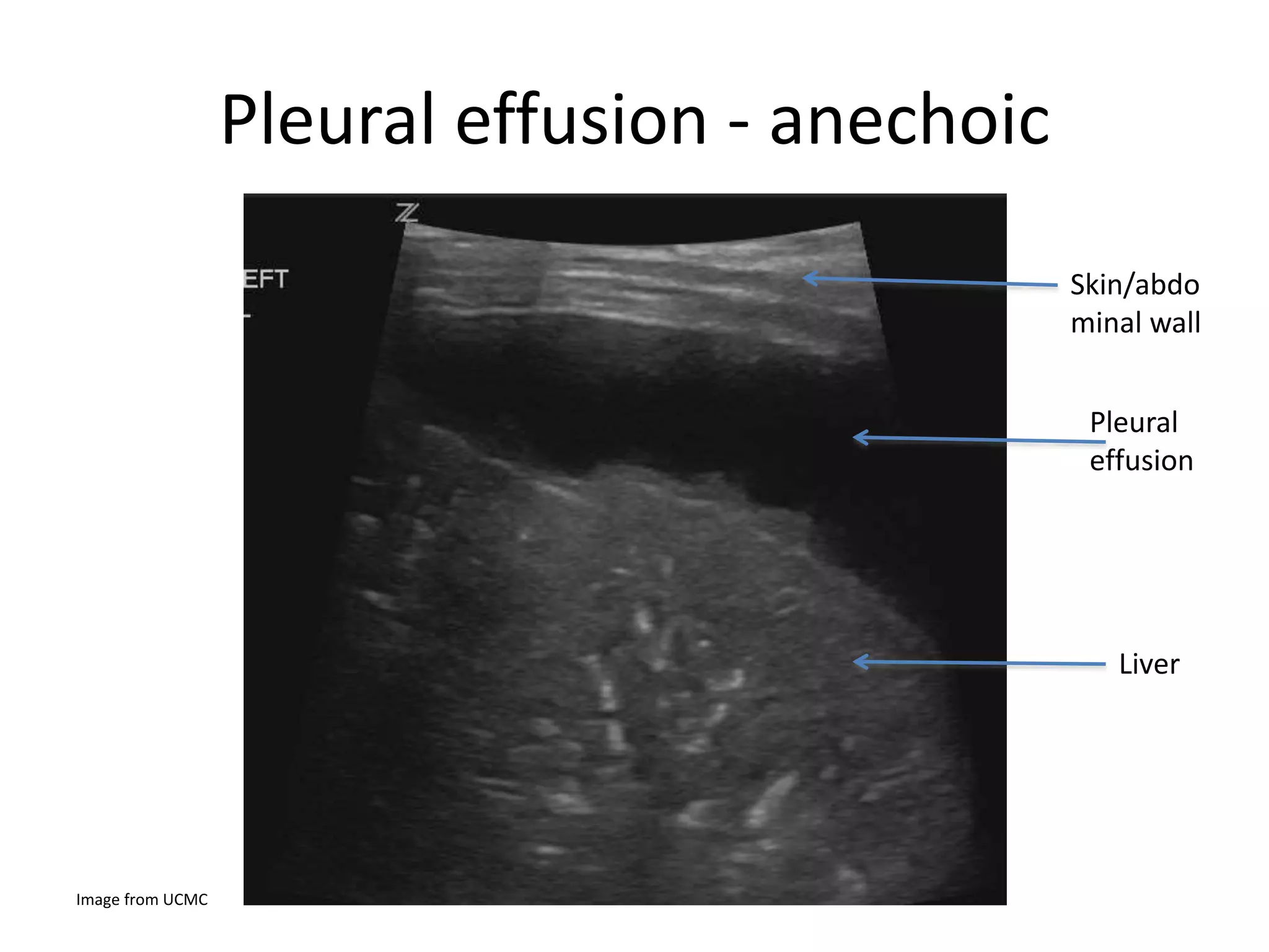 Ultrasound Basics.ppt