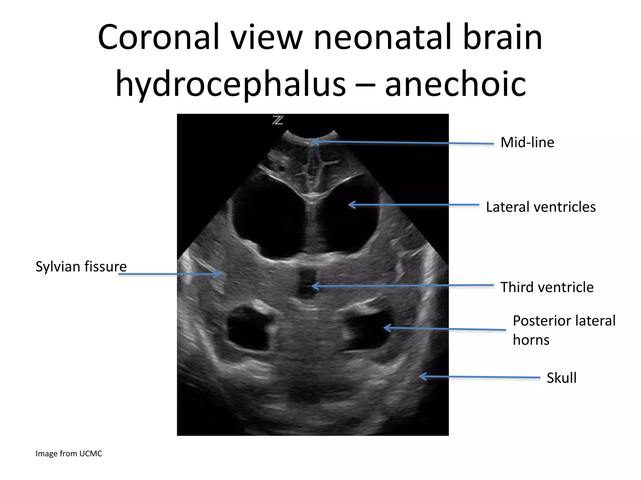 Ultrasound Basics.ppt