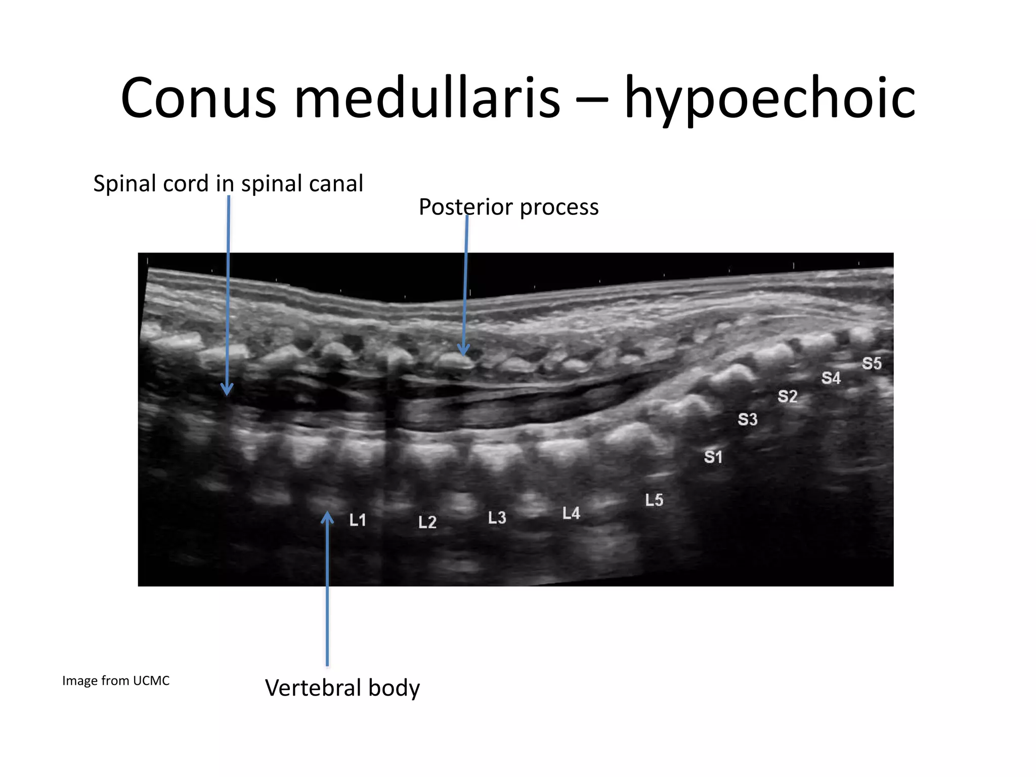 Ultrasound Basics.ppt