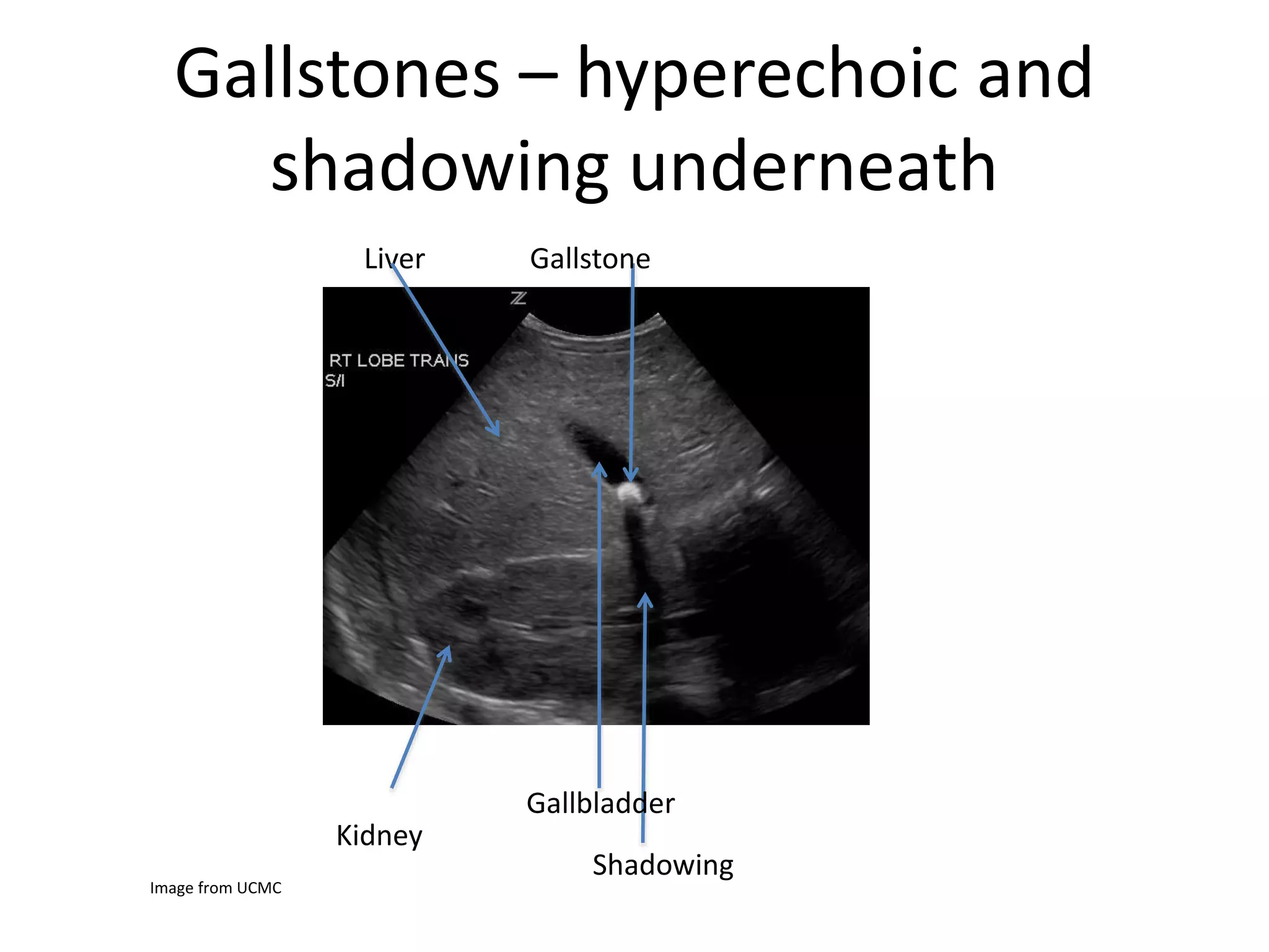 Ultrasound Basics.ppt