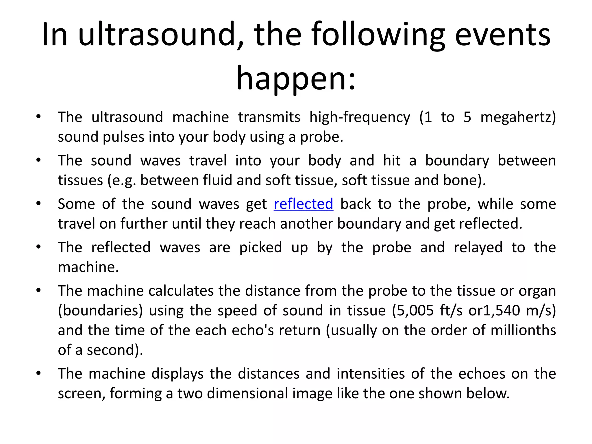 Ultrasound Basics.ppt