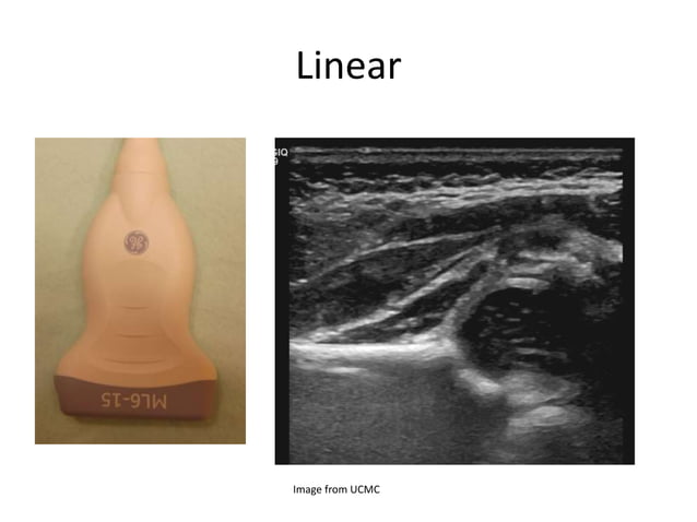 Ultrasound Basics.ppt