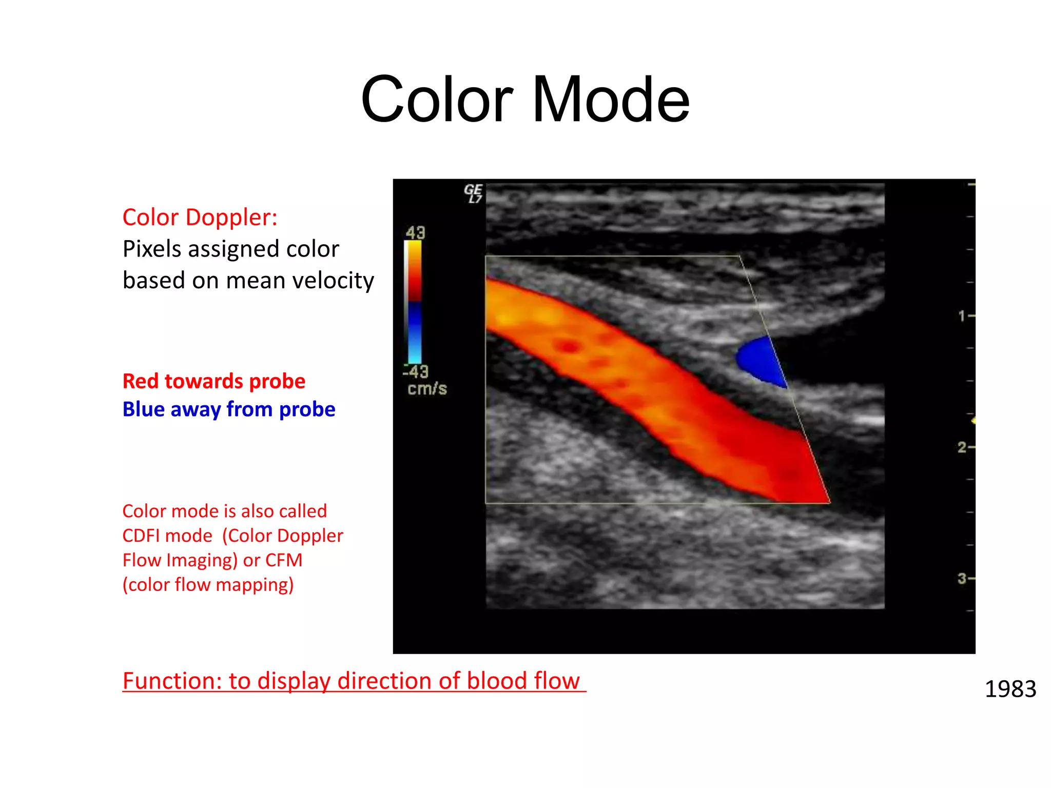 Ultrasound Basics.pptx