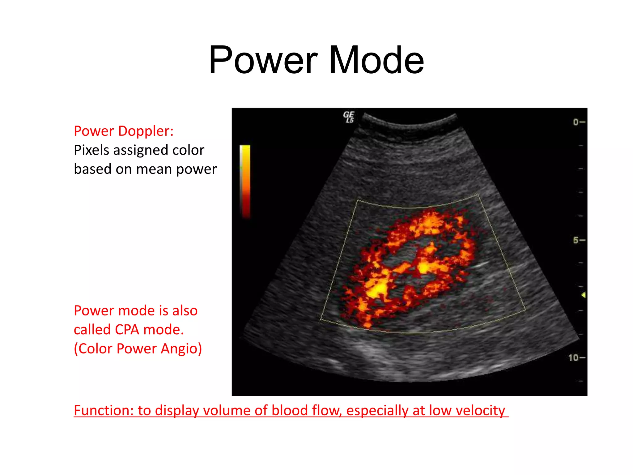Ultrasound Basics.pptx