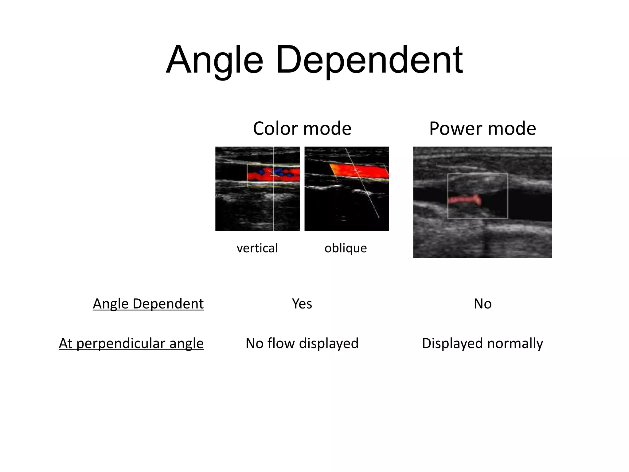 Ultrasound Basics.pptx
