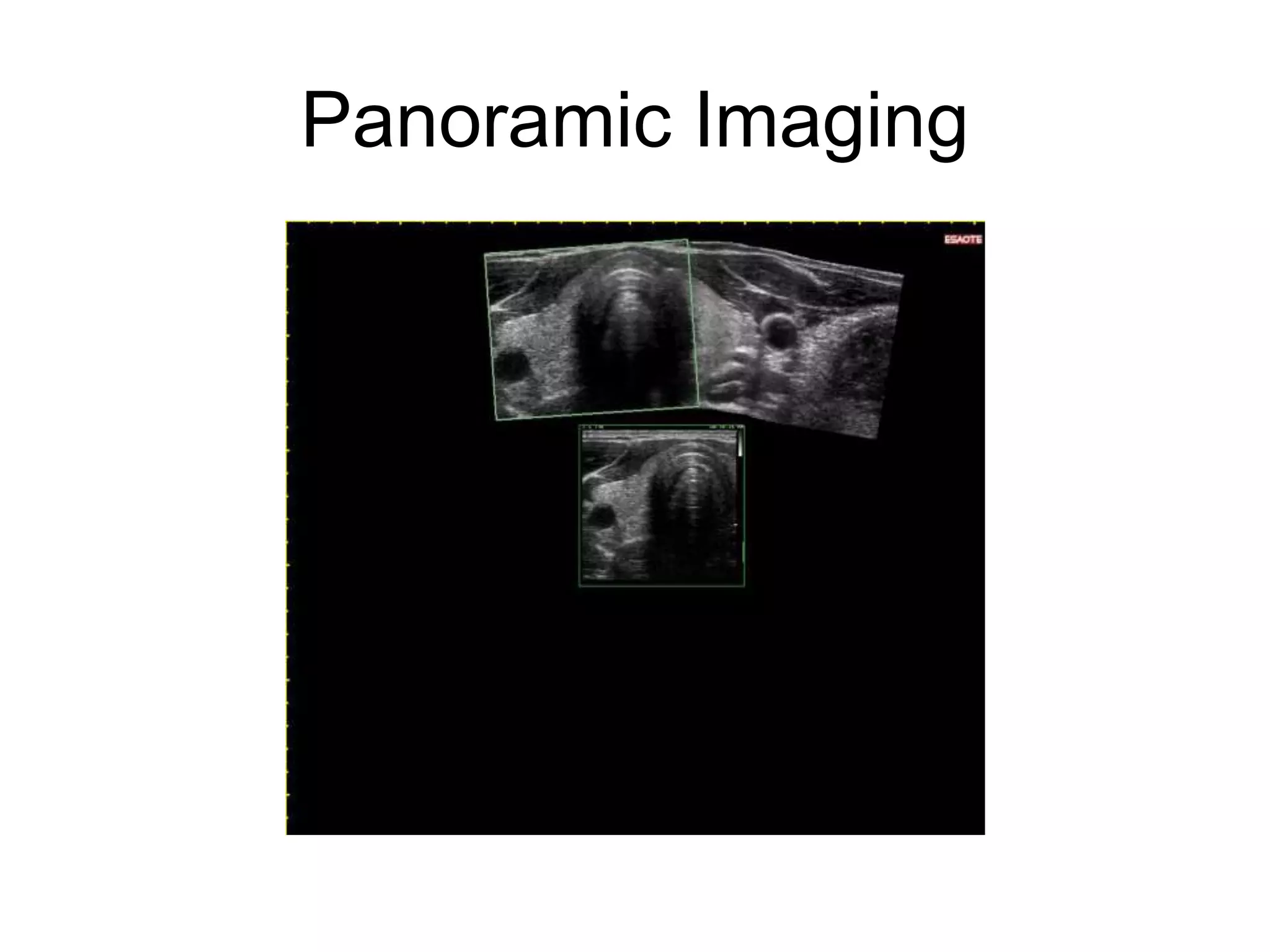 Ultrasound Basics.pptx